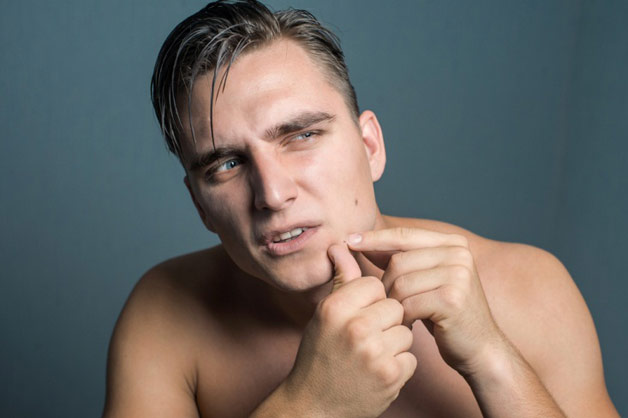 Groom service: Simple tips for men to say 'bye-bye' to pimples